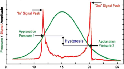 Ocular Response Analyzer - Vision Science Academy