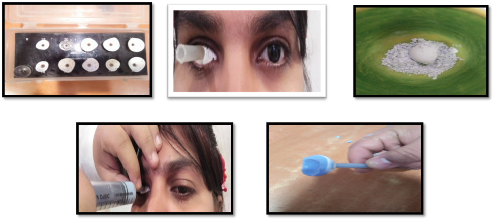 Ocular Prosthesis- Eye with an Art - Vision Science Academy