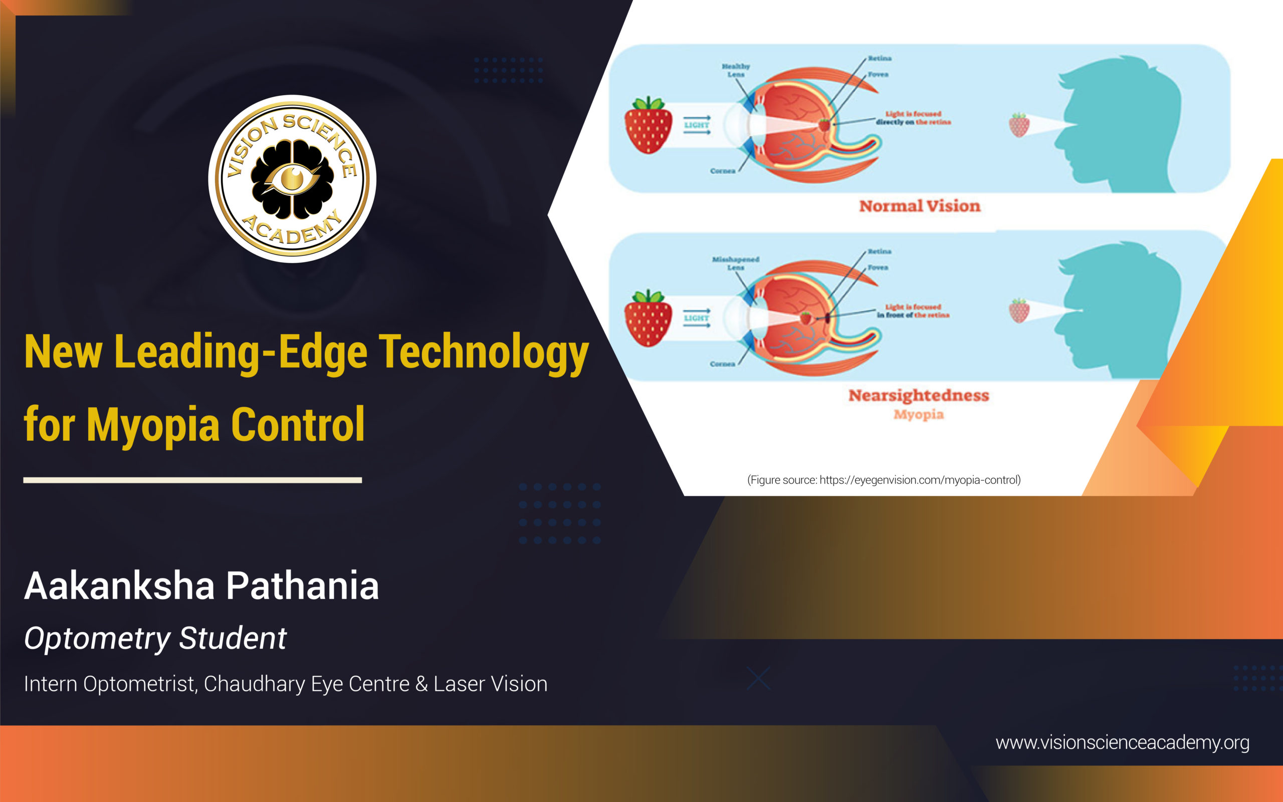 New Leading-Edge Technology for Myopia Control - Vision Science Academy