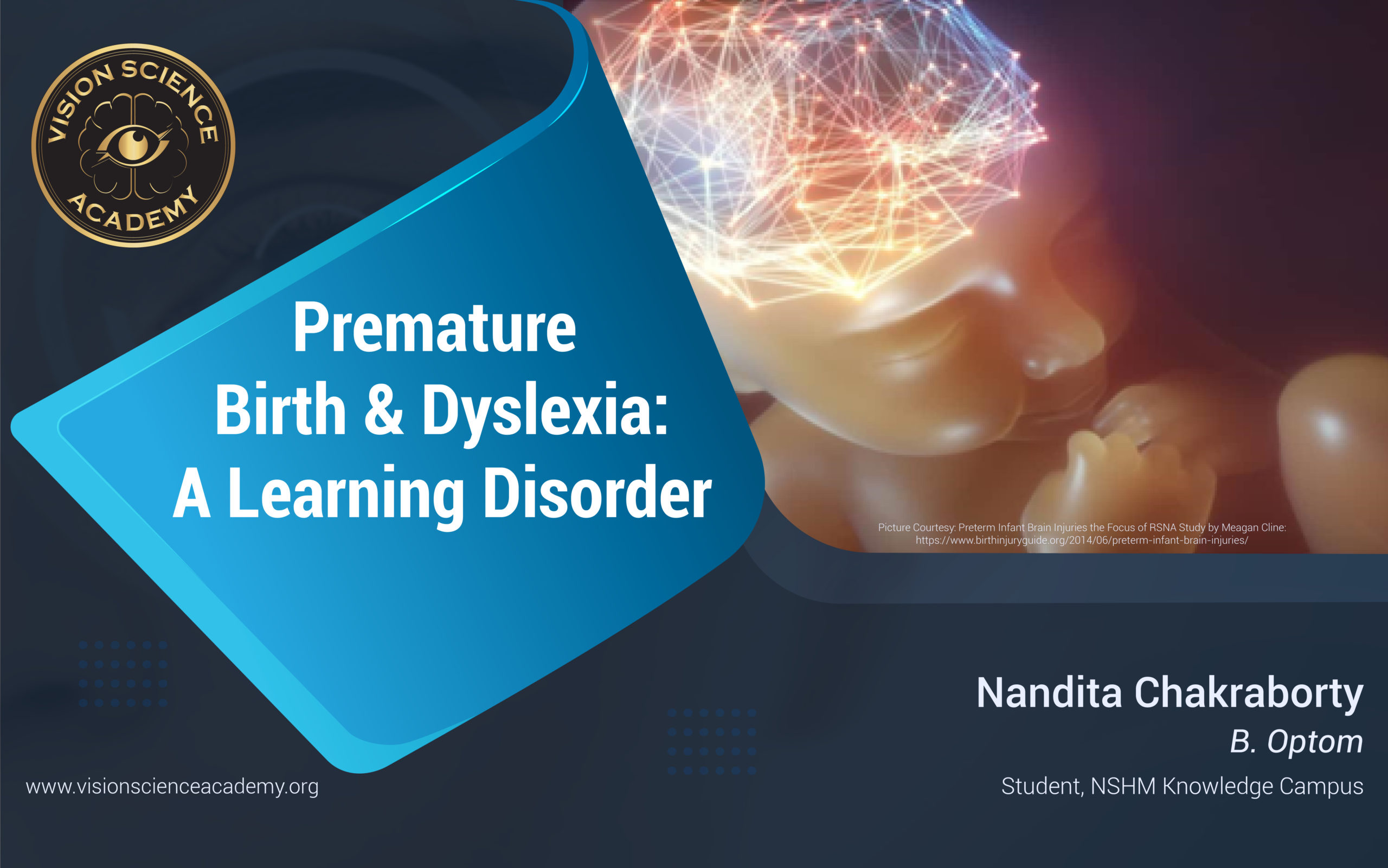 Premature Birth & Dyslexia: A Learning Disorder - Vision Science Academy