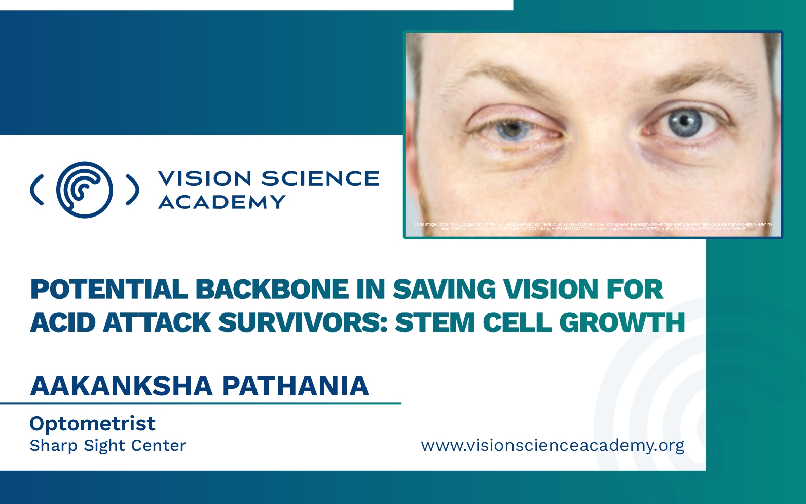 Potential Backbone in Saving Vision for Acid Attack Survivors: Stem ...