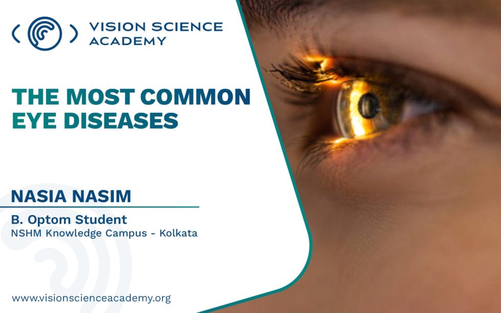The Most Common Eye Diseases - Vision Science Academy