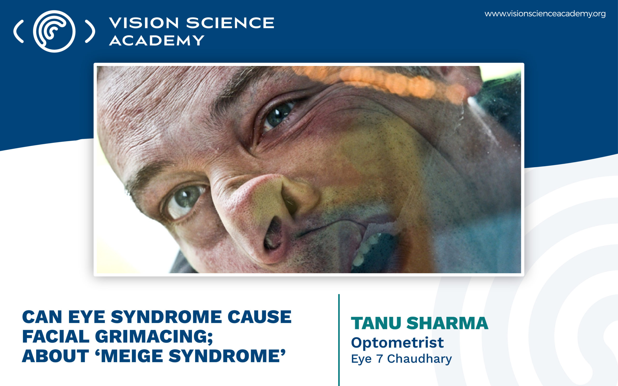Can Eye Syndrome Cause Facial Grimacing; About ‘Meige Syndrome’ - Vision Science Academy