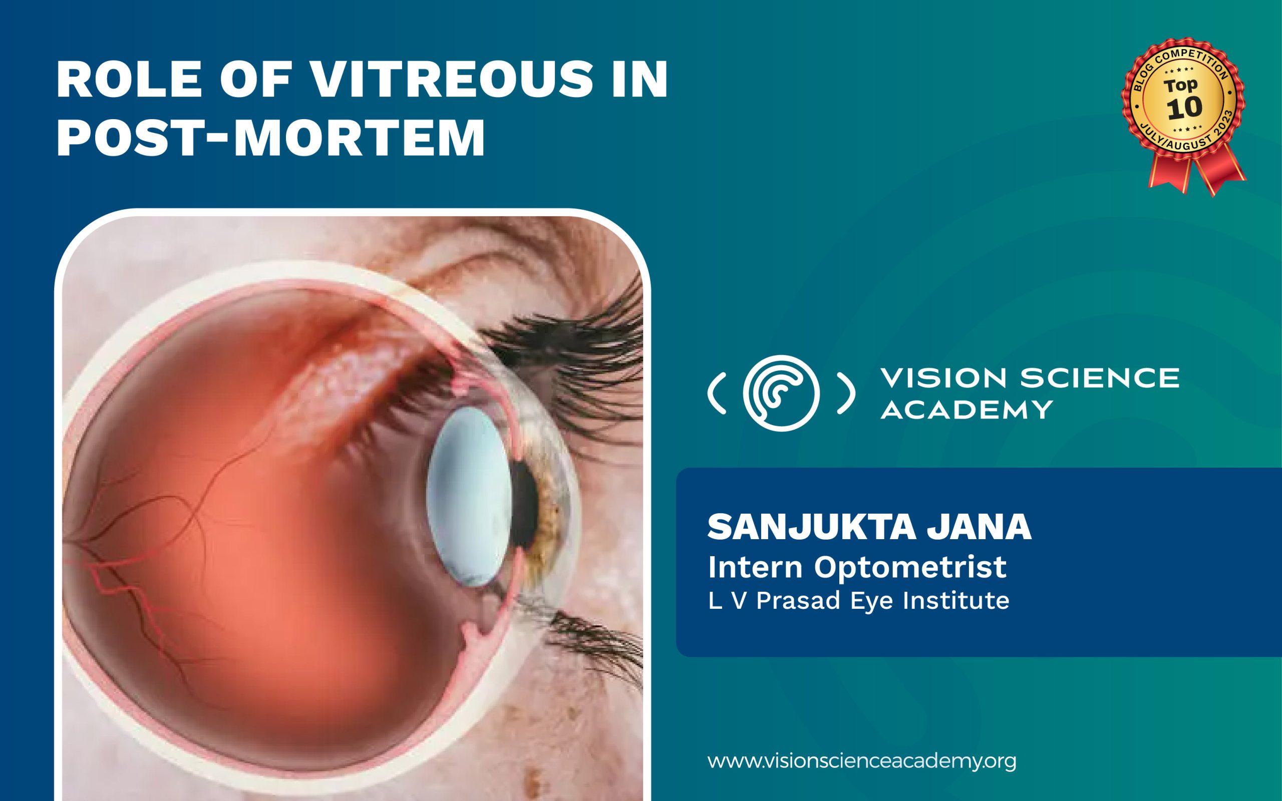Role of Vitreous In Post-Mortem - Vision Science Academy