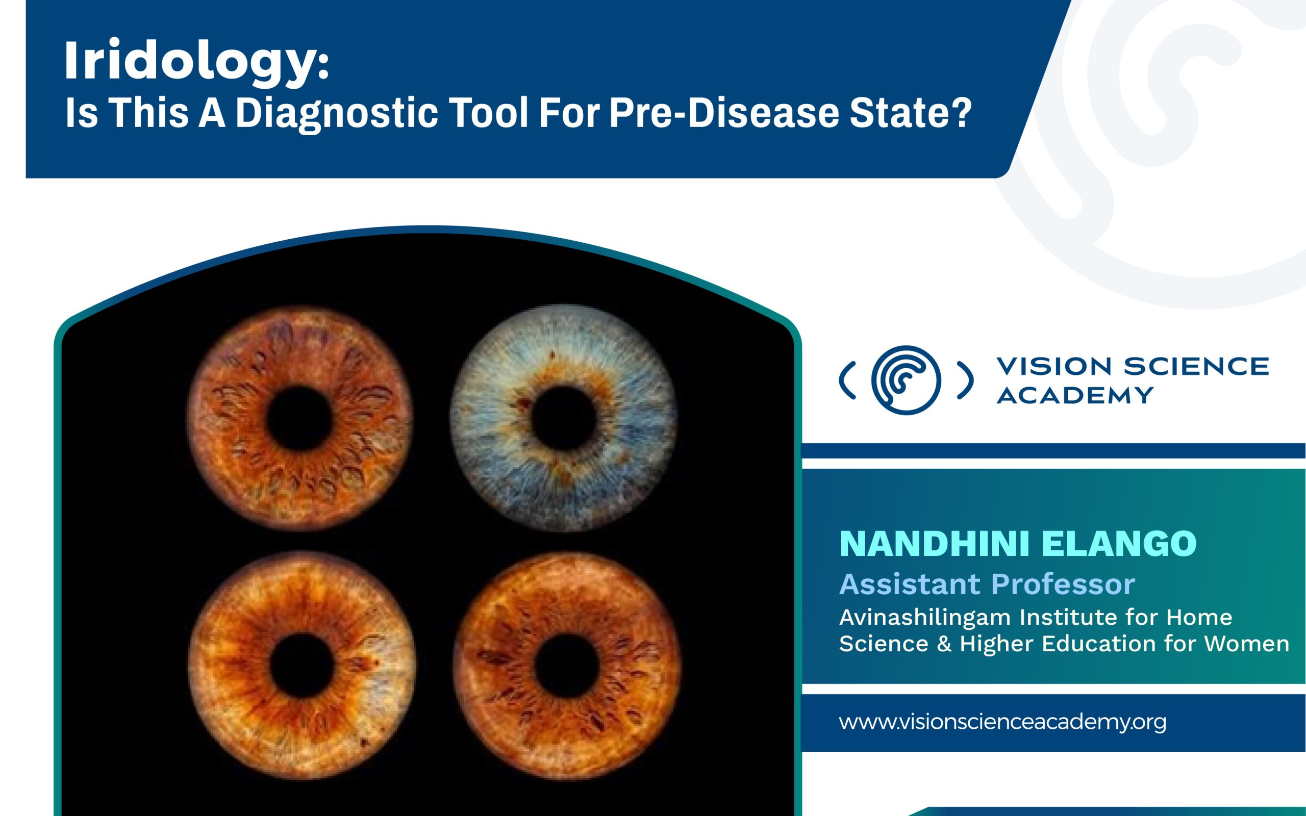 Iridology: Is This A Diagnostic Tool For Pre-Disease State? - Vision Science Academy